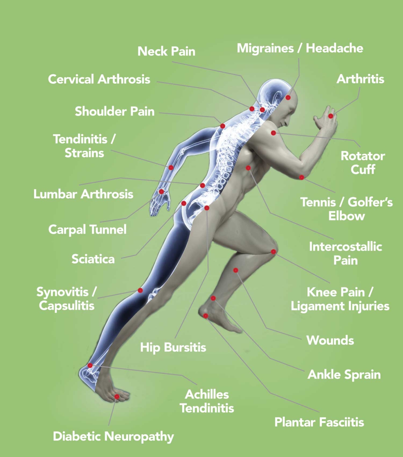 Theralase® CLT Cool Laser Therapy | Book CLT Now